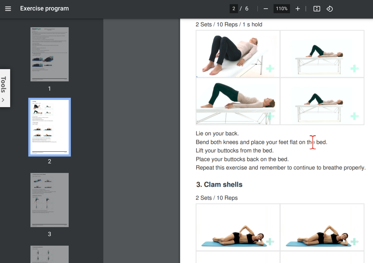 Hip Bursitis Plan | ZoomPhysio